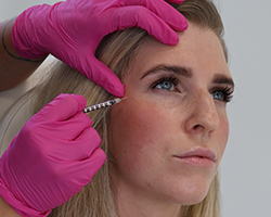 Kindben/Kinder - Allure Clinic